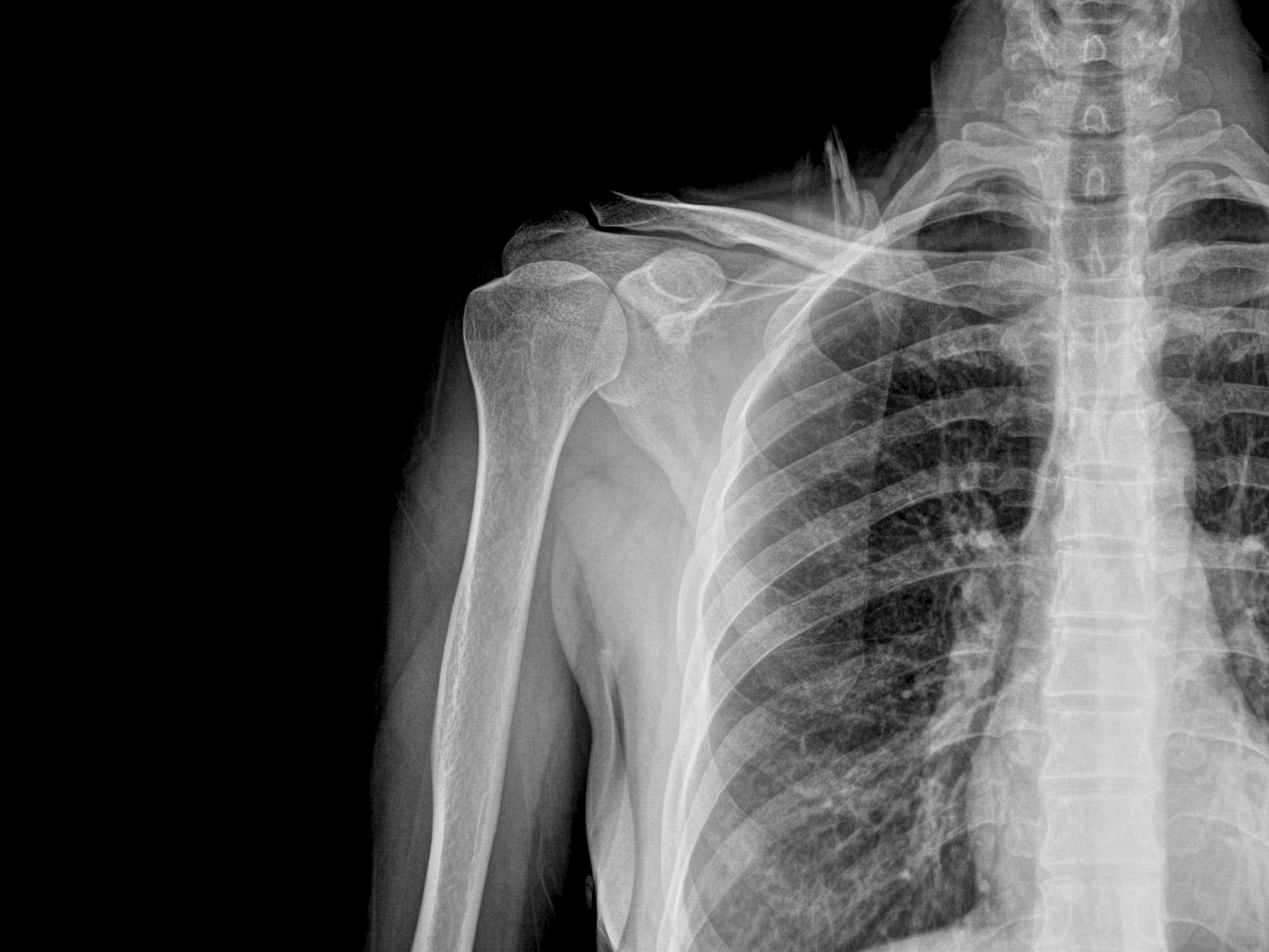 X-Ray Duplication & Digitization | The MCS Group, Inc. X-Ray Duplication & Digitization | The MCS Group, Inc.