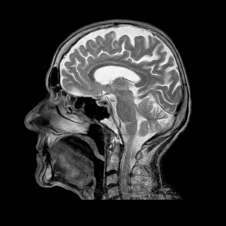 MCS DICOM Viewer | MCS Group